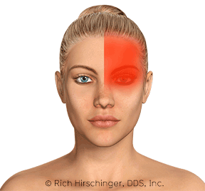 Causes of Headaches | Beverly Hills | Los Angeles | Dr. Rich Hirschinger