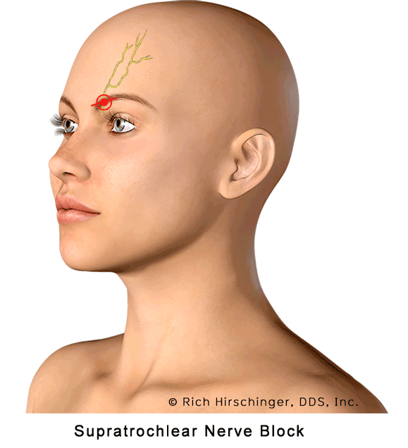 Supratrochlear Supraorbital Infraorbital and Auriculotemporal ...