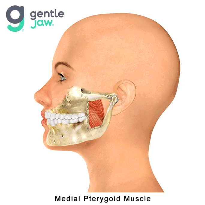 Muscles that Refer Pain into the TMJ